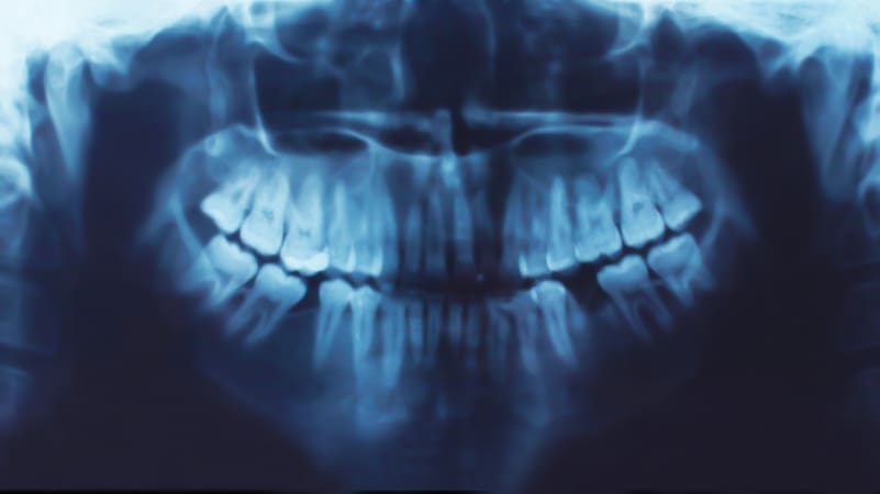 Digital X Rays - Unique Dental of Worcester